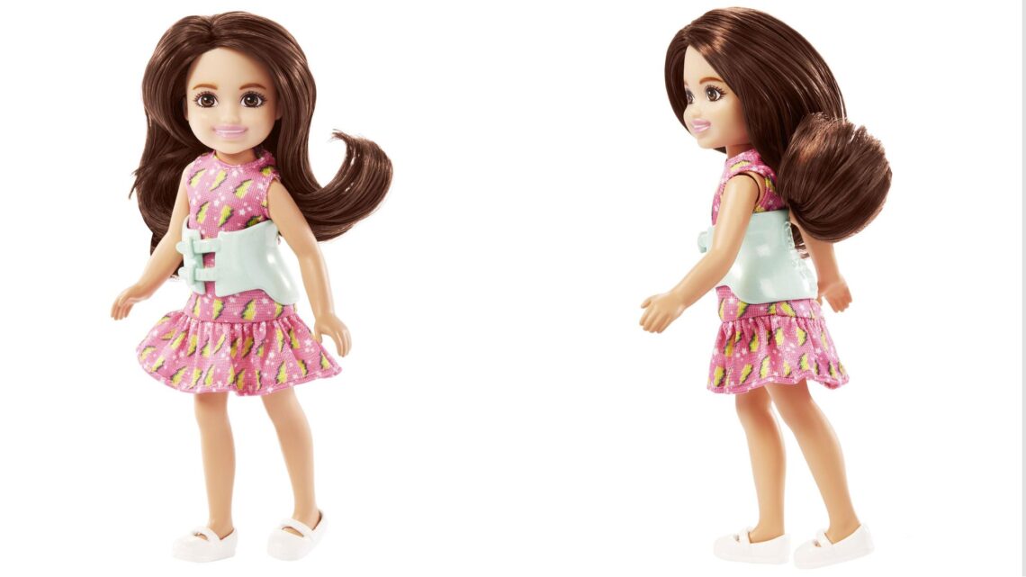 Barbie perkenal anak patung skoliosis - Utusan Malaysia