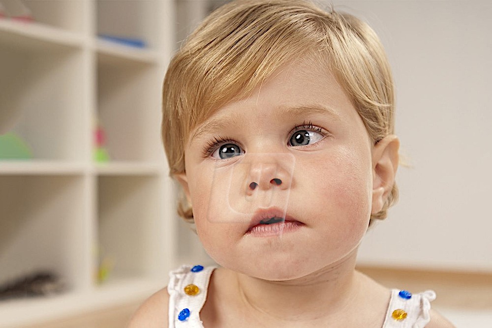 Ptosis tingkat risiko rabun silau, ambliopia - Utusan Malaysia