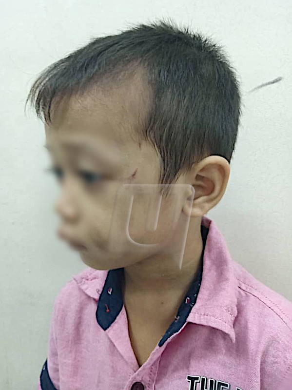 Kanak-kanak lelaki 5 tahun dipercayai didera ibu, teman lelaki - Utusan Malaysia