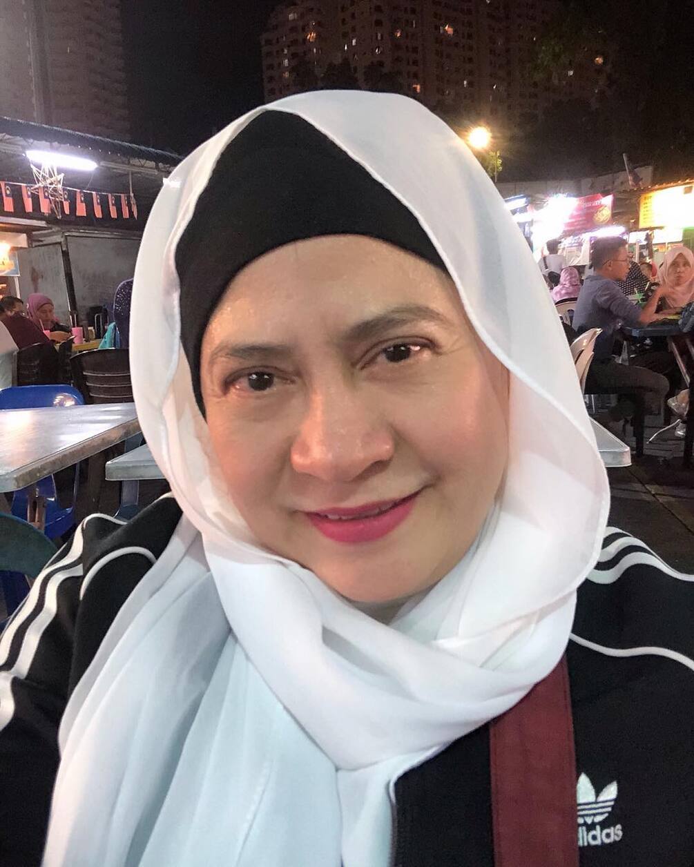 Connie Ahmad alami buah pinggang bernanah - Utusan Malaysia Connie Ahmad alami buah pinggang bernanah - Utusan Malaysia