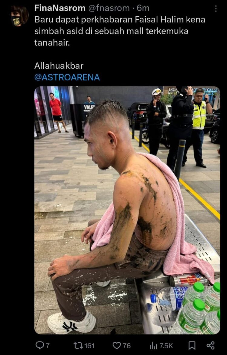 Faisal Halim cedera disimbah asid