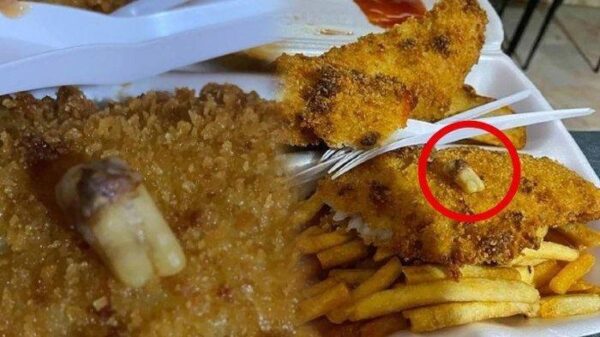 Gigi manusia dalam fish & chip - Utusan Malaysia